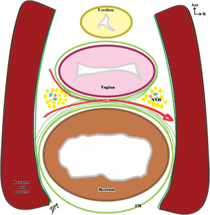 Concepts of the rectovaginal septum: implications for function and ...