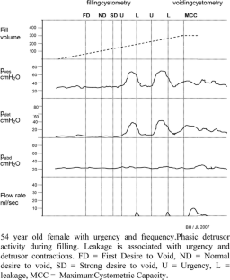 An International Urogynecological Association (IUGA) / International ...