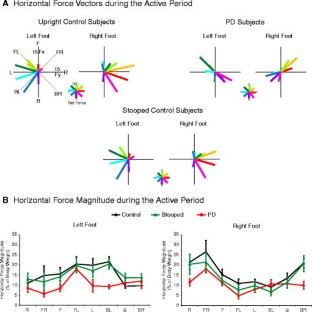 Can stooped posture explain multidirectional postural instability in ...