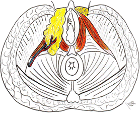 Martius flap: historical and anatomical considerations | SpringerLink