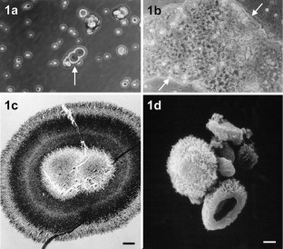 Characteristics of nanobacteria and their possible role in stone ...