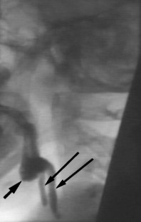 Current practice in paediatric videofluoroscopy | SpringerLink