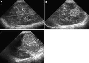 Mastoid fontanelle approach for sonographic imaging of the neonatal ...
