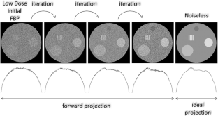 Iterative reconstruction: how it works, how to apply it | SpringerLink