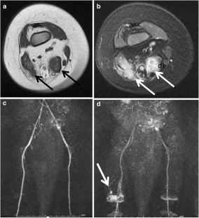 Gadolinium-based contrast agents in pediatric magnetic resonance ...
