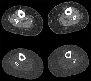 A case report: radiological findings in an unusual case of ...