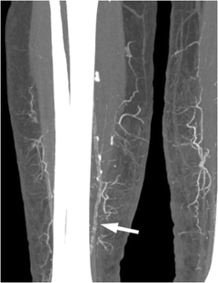 A case report: radiological findings in an unusual case of ...
