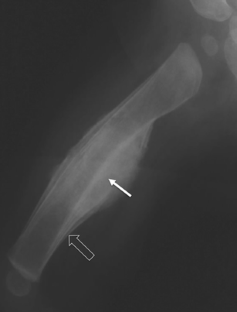 Periosteum: Characteristic imaging findings with emphasis on radiologic ...