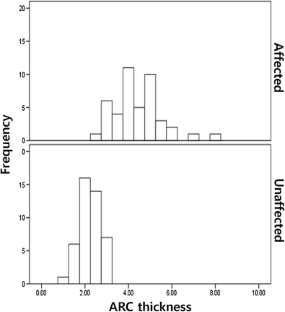 Ultrasound measurements of axillary recess capsule thickness in ...