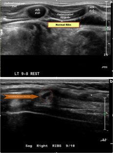 Dynamic ultrasound in the evaluation of patients with suspected ...