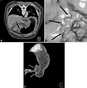 CT gastrography | SpringerLink