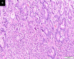 MDCT and MRI of the ampulla of Vater (part I): technique optimization ...