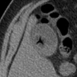 The Mercedes-Benz sign | SpringerLink