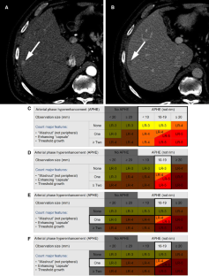 LI-RADS ® algorithm: CT and MRI | SpringerLink