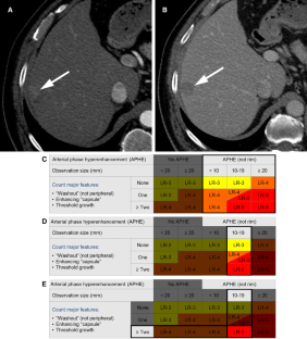 LI-RADS ® algorithm: CT and MRI | SpringerLink
