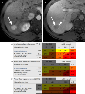 LI-RADS ® algorithm: CT and MRI | SpringerLink