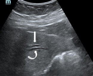 Double-barrel shotgun sign | SpringerLink