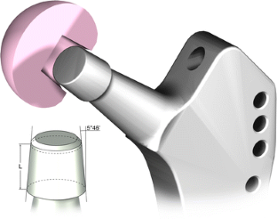 Radiological identification of Zweymüller-type femoral stem prosthesis ...