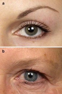 The Blue-Eyes Stereotype: Do Eye Color, Pupil Diameter, and Scleral ...