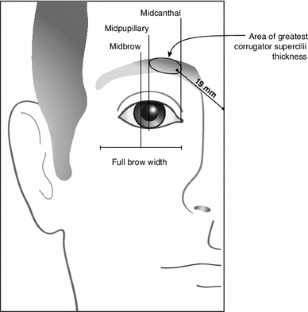 Understanding the Functional Anatomy of the Frontalis and Glabellar ...