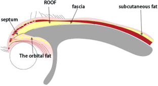 Anatomical Study and Clinical Observation of Retro-orbicularis Oculi ...