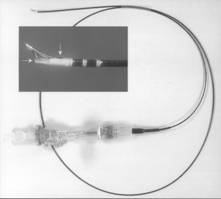 The Outback Catheter: A New Device for True Lumen Re-entry After ...