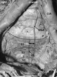 Surgical anatomy of the presacral area | SpringerLink