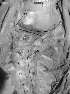 Surgical anatomy of the presacral area | SpringerLink