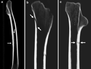 The demonstration of the number, course, and the location of nutrient ...
