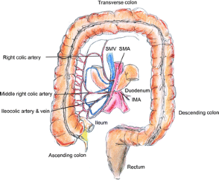 The ileocolic vein passing through the ring-shaped part of ileocolic ...