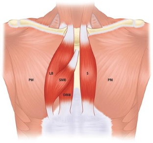 A previously unclassified variant of sternalis muscle | SpringerLink
