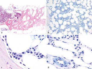 Normales Knochenmark und häufige reaktive Veränderungen | SpringerLink