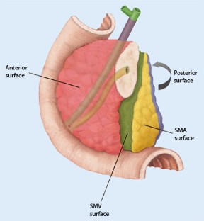 Resection margins in pancreatic cancer | SpringerLink