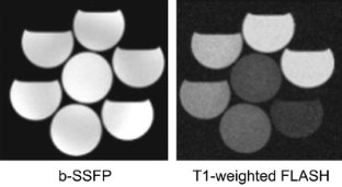 Principles and applications of balanced SSFP techniques | SpringerLink