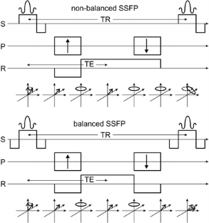 Principles and applications of balanced SSFP techniques | SpringerLink
