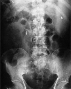 Gastrointestinal parasite infestation | SpringerLink