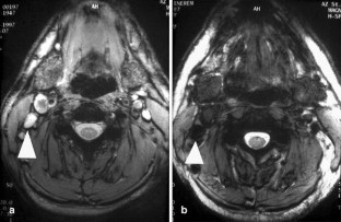 Imaging the lymphatic system: possibilities and clinical applications ...