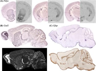 High-resolution gene expression atlases for adult and developing mouse ...