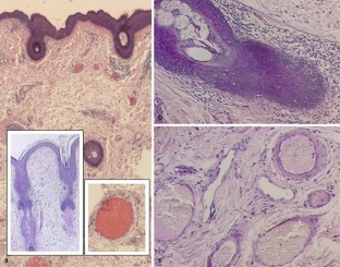 Morbus Morbihan | SpringerLink
