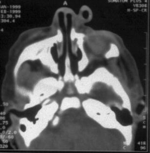 Proboscis lateralis | SpringerLink