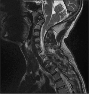 The odontoid process: a comprehensive review of its anatomy, embryology ...