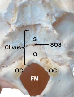 A comprehensive review of the clivus: anatomy, embryology, variants ...
