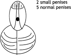 True hermaphroditism in southern Africa: the clinical picture ...