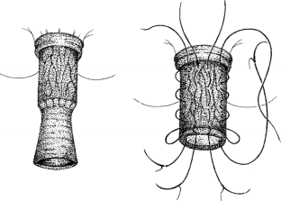 Delorme's procedure for rectal prolapse in a child refractory to ...