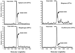 Clinical and pathological studies of familial amyotrophic lateral ...
