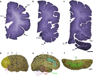 Autism spectrum disorder: neuropathology and animal models | SpringerLink
