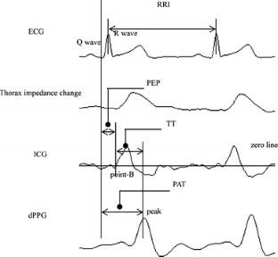 The effects of pre-ejection period on post-exercise systolic blood ...
