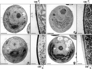 Late type of daughter cell wall synthesis in one of the Chlorellaceae ...