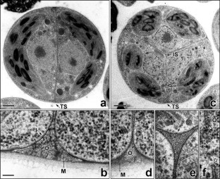 Late type of daughter cell wall synthesis in one of the Chlorellaceae ...