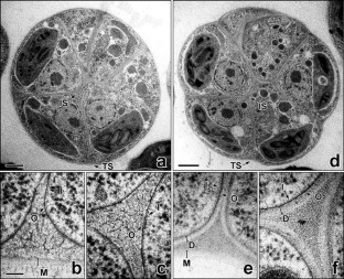 Late type of daughter cell wall synthesis in one of the Chlorellaceae ...